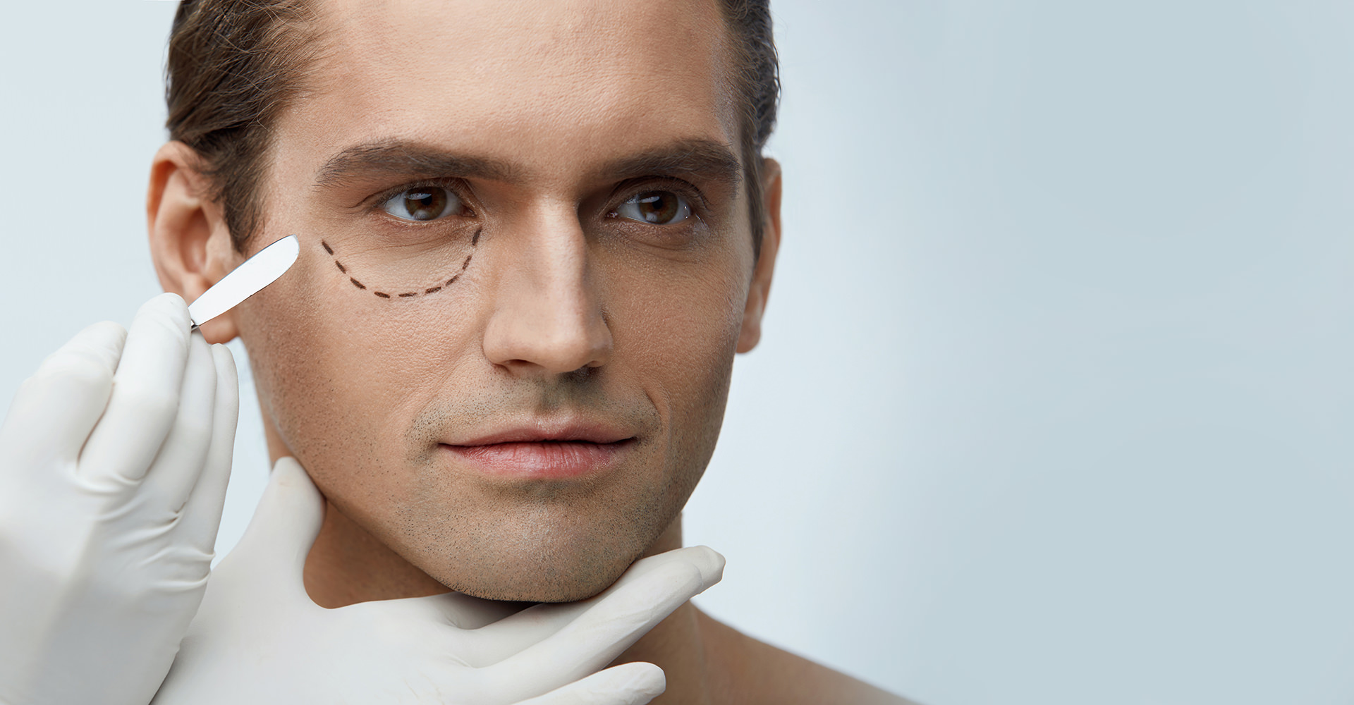 Blepharoplasty, Eyelid Surgery Toronto, Richmond Hill Dr Chad Wu ...