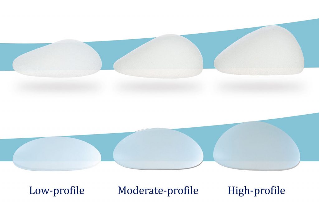 Choosing Breast Implant Profiles for Augmentation in Toronto